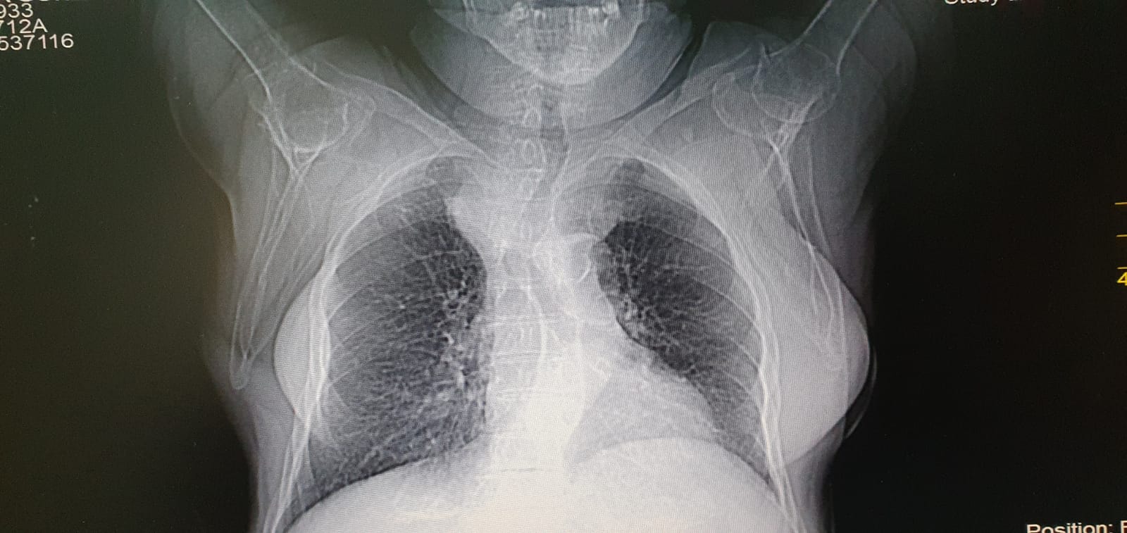 EL RINCÓN DE LA MEDICINA INTERNA: 20 ago 2020
