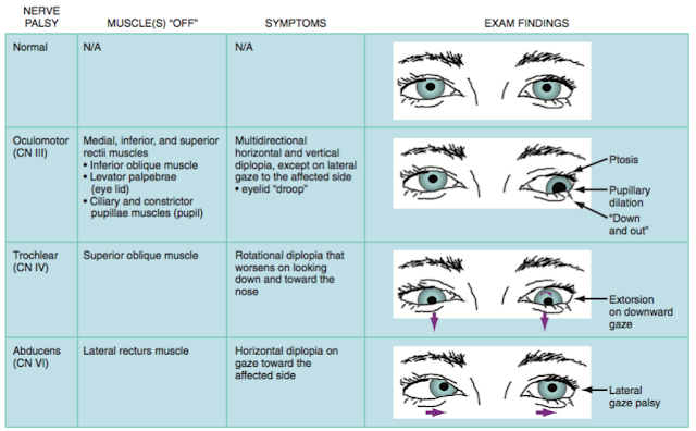EM Didactic: Diplopia - ED evaluation