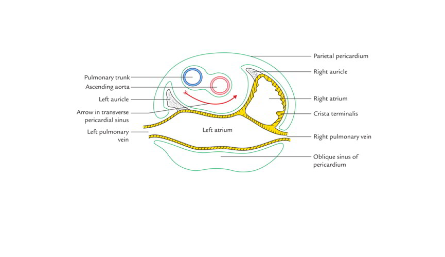 easyhumanatomy: Summary of oblique sinus of pericardium with clinical ...
