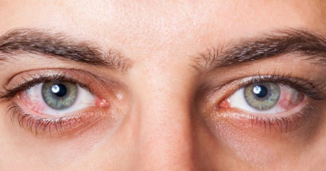 4 Problemas en tus ojos que no debes ignorar