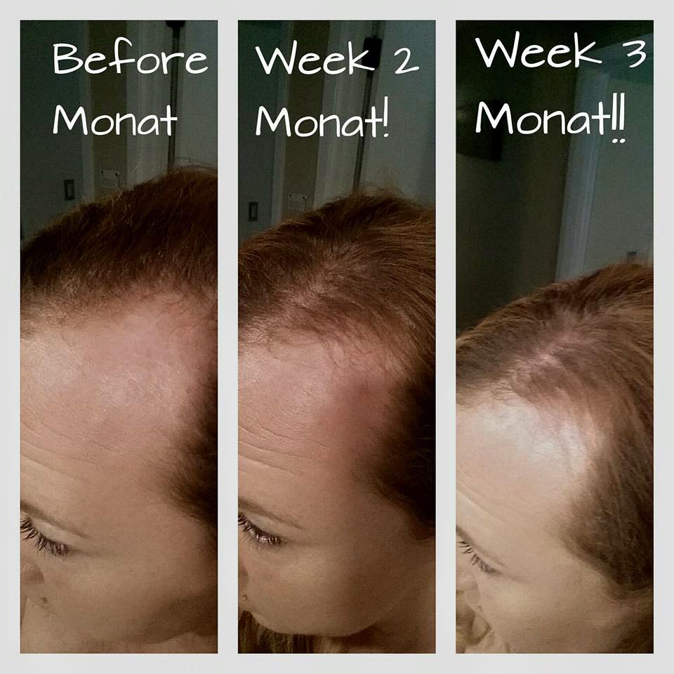 MONAT Global Revolutionary Hair Care Products: Is your hair thinning or ...