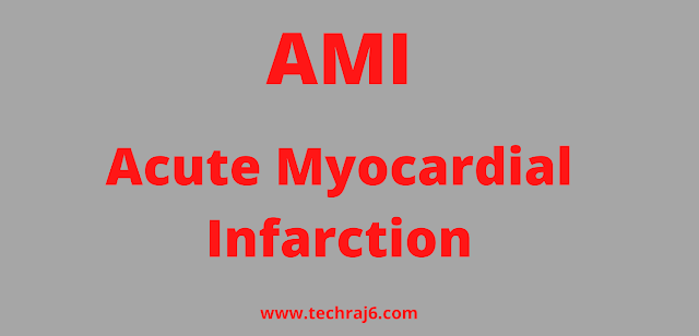 AMI full form, What is the full form of AMI