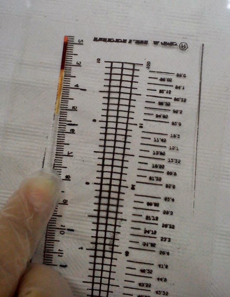 cuaderno-de-hematolog-a-hematocrito