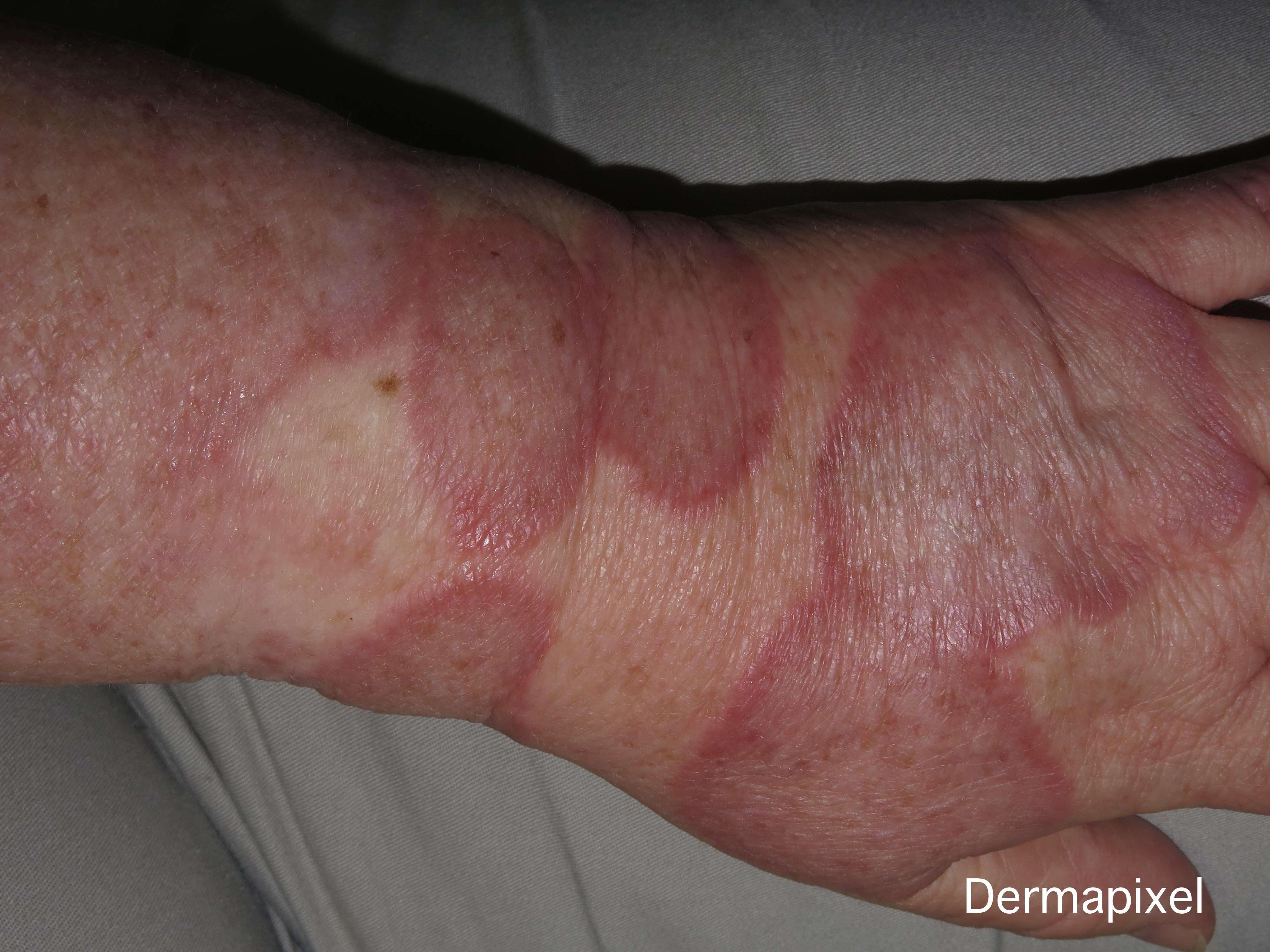 Dermapixel: junio 2021