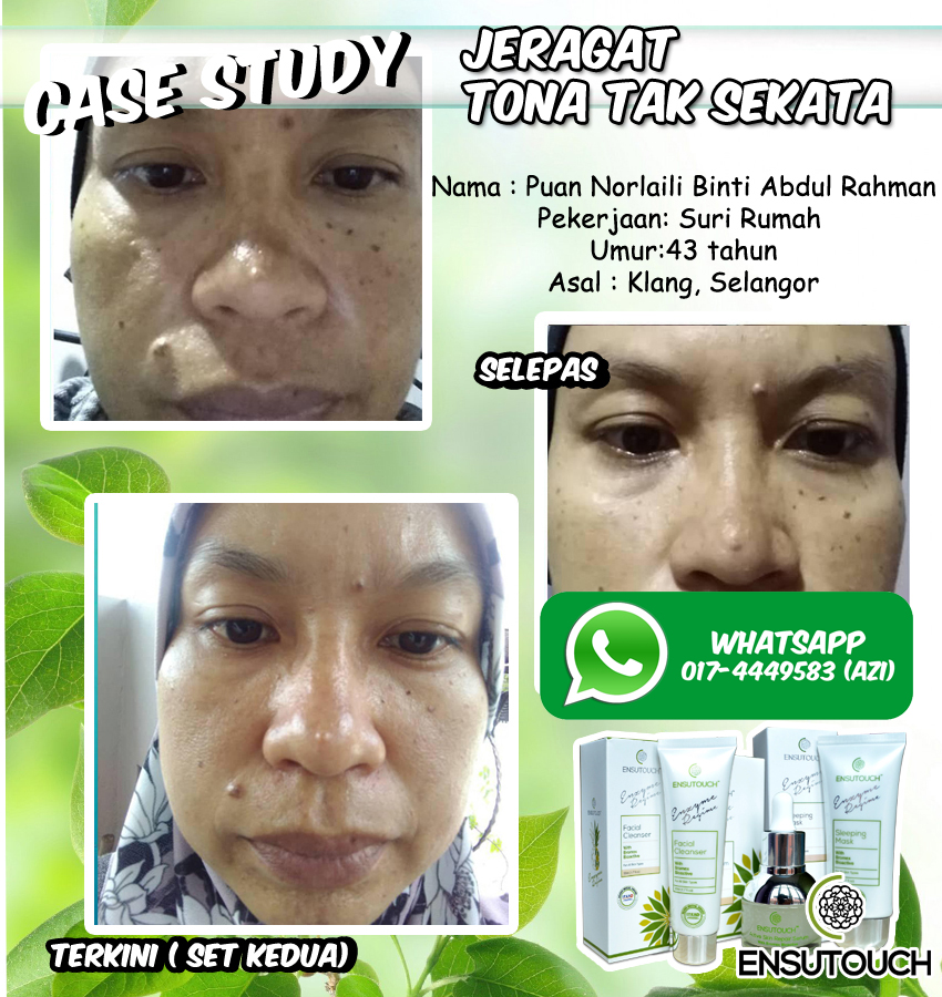 Stokis Sah Ensutouch Skincare