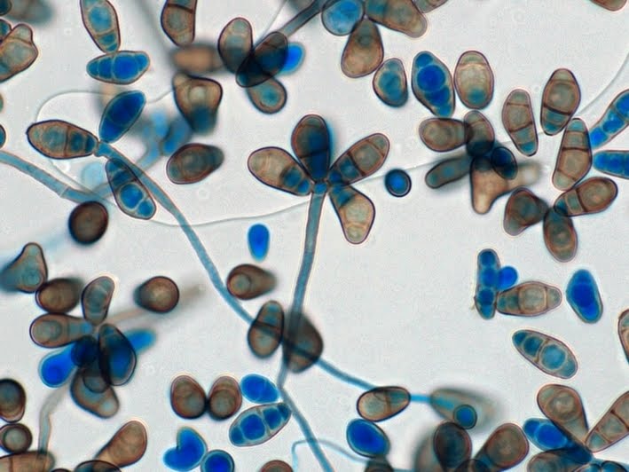 Fun With Microbiology (What's Buggin' You?): Curvularia sp.