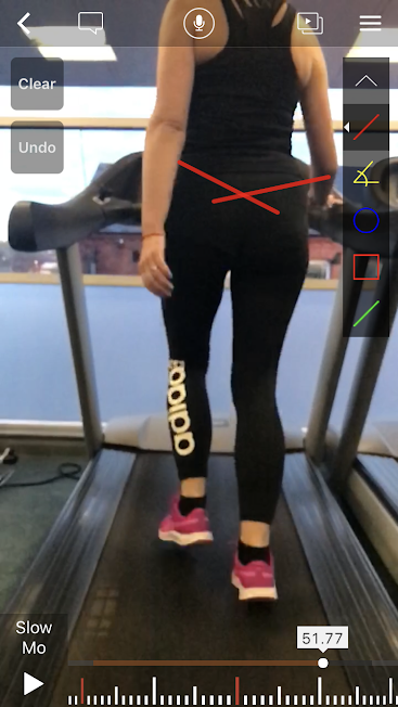 Dynamic Postural Assessment