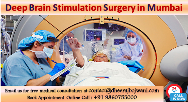 International Patients prefer to get Deep Brain Stimulation Surgery in ...
