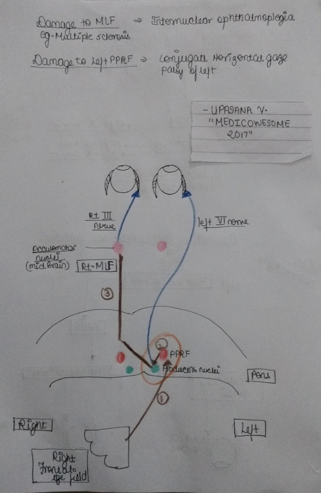 Medicowesome: Paramedian pontine reticular formation and MLF