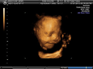 My First Year As Mrs G Beecham & Beyond: So Much To Tell...Very ...