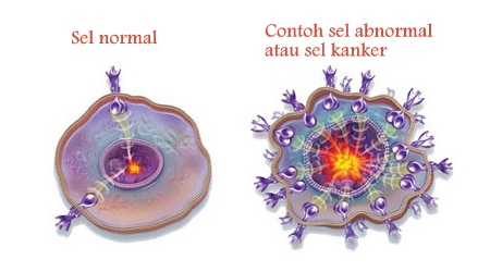 Kanker Anak: Fakta, Jenis, dan Gejala | Medkes