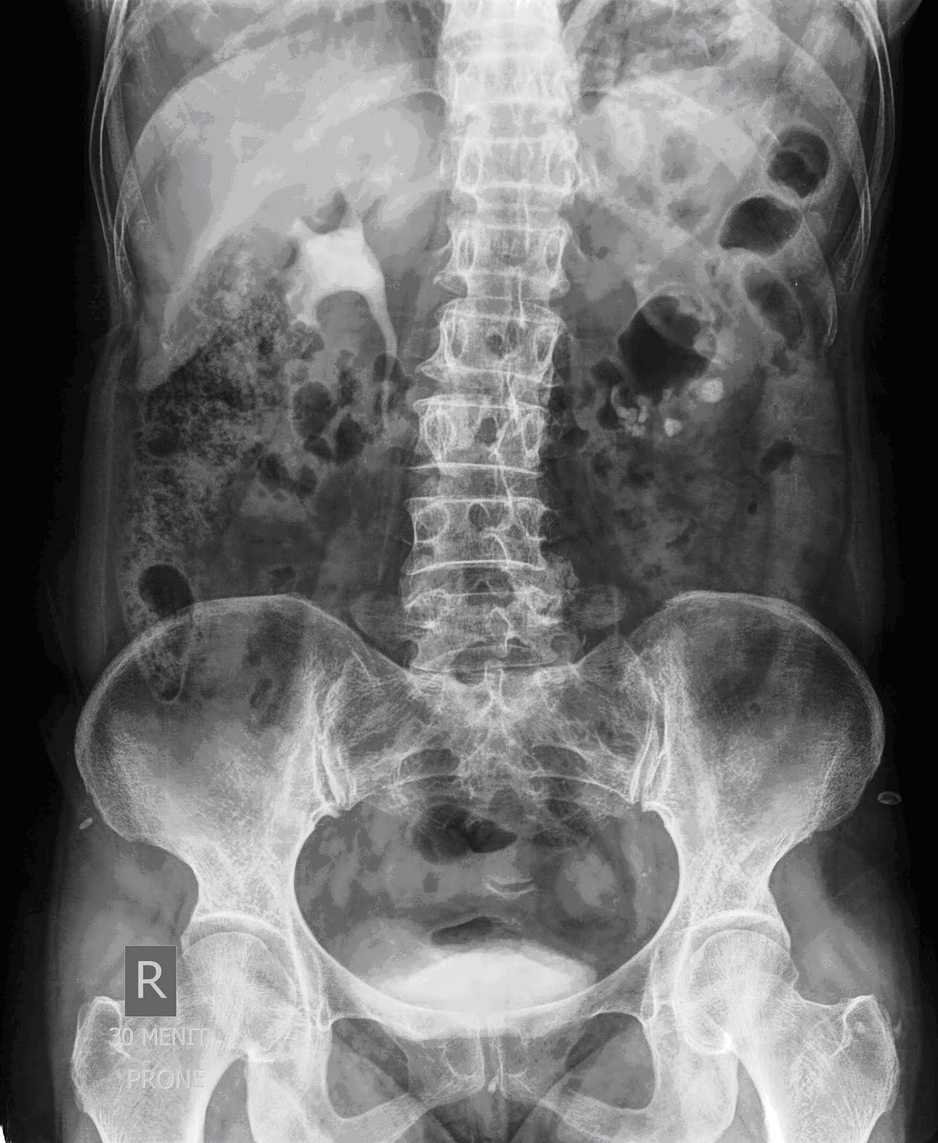 KONTRAS MEDIA RADIOLOGI