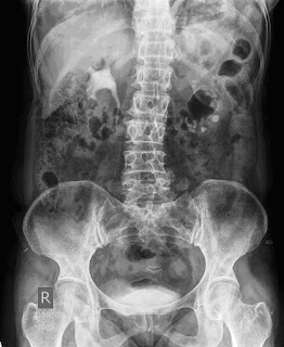 KONTRAS MEDIA RADIOLOGI