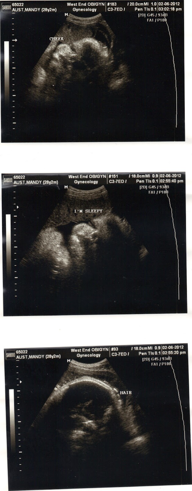 Live.Laugh.Love: 36 week ultrasound and check-up