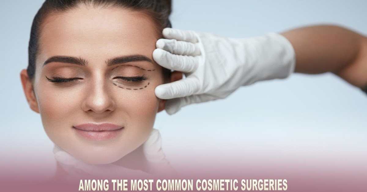 Among the Most Common Cosmetic Surgeries
