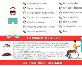 Elephantiasis - Elephantitis Cure