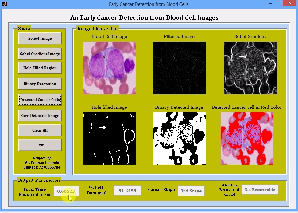 Blood Leukemia Cancer Detection Using Image Processing Matlab Project ...
