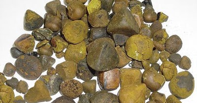 Say goodbye to gallbladder stones with this home remedy ~ Lifestyle ...