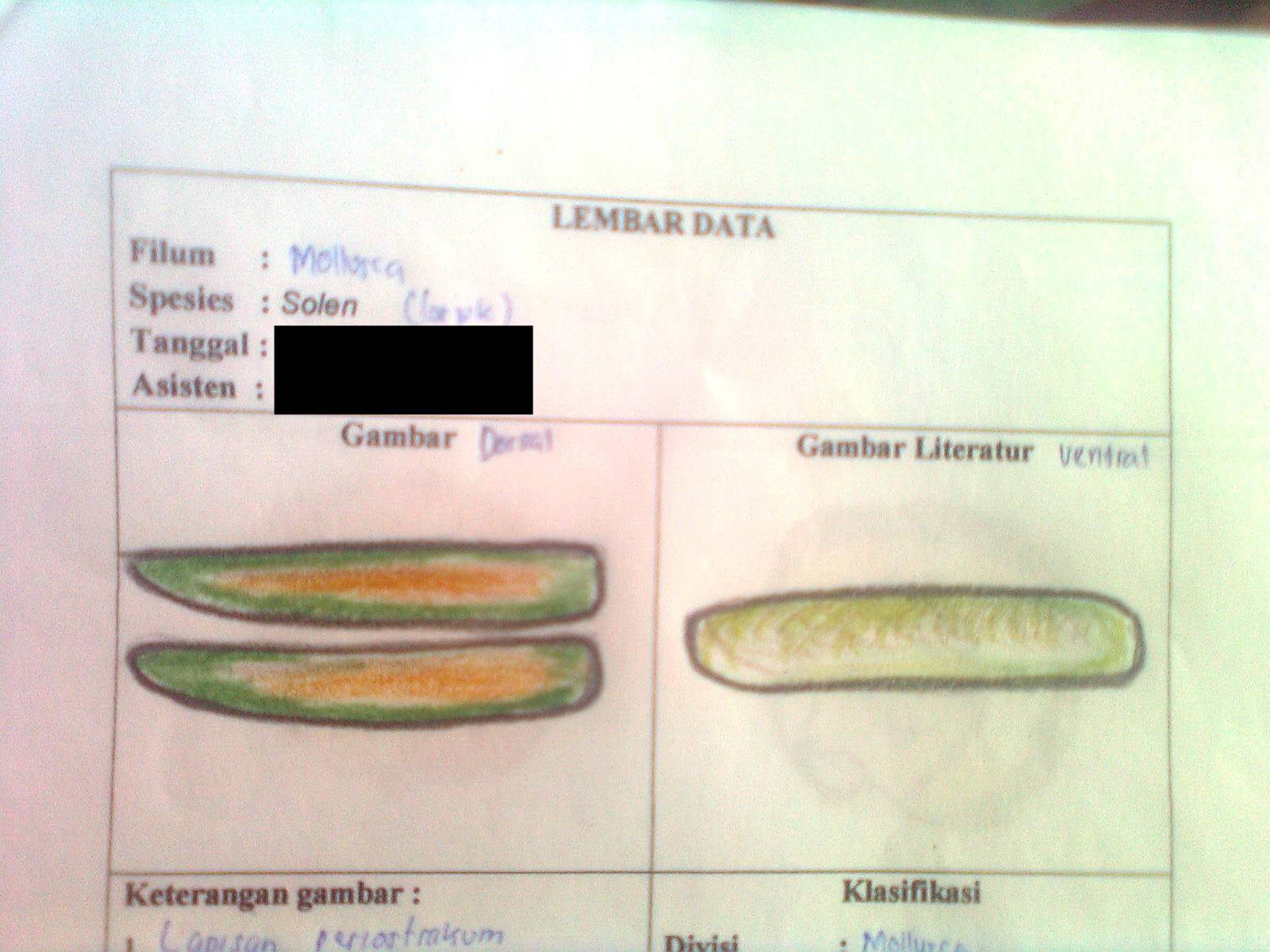 Gambar Ventral dan Dorsal Praktikum Avertebrata Bagian 2 - RS Blog Gambar Ventral dan Dorsal Praktikum Avertebrata Bagian 2 - RS Blog