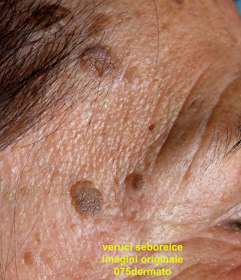 DERMATOLOGIA APROAPE DE TINE CABINET DERMATOLOGIE IASI DERMATOLOG ...