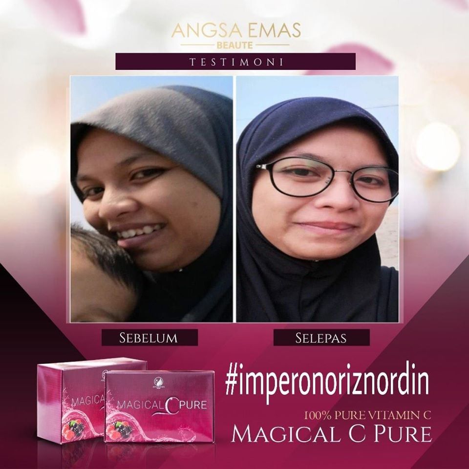 MAGICAL C PURE: Kebaikan Vitamin C 1000mg Asli Glow White Menakjubkan!