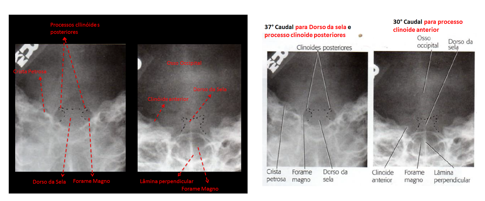 Laboratório de Roentgen: Crânio e Face