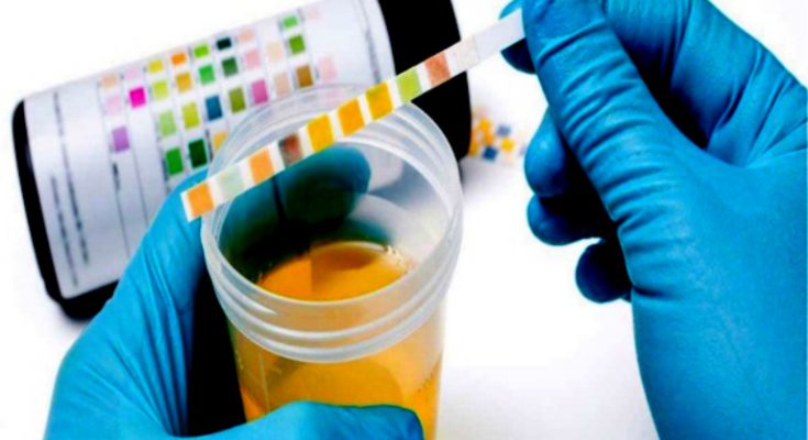 PENGURUSAN SURAT BEBAS NARKOBA (NAPZA)