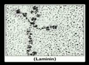Devocionando: Vc conhece a Laminina?