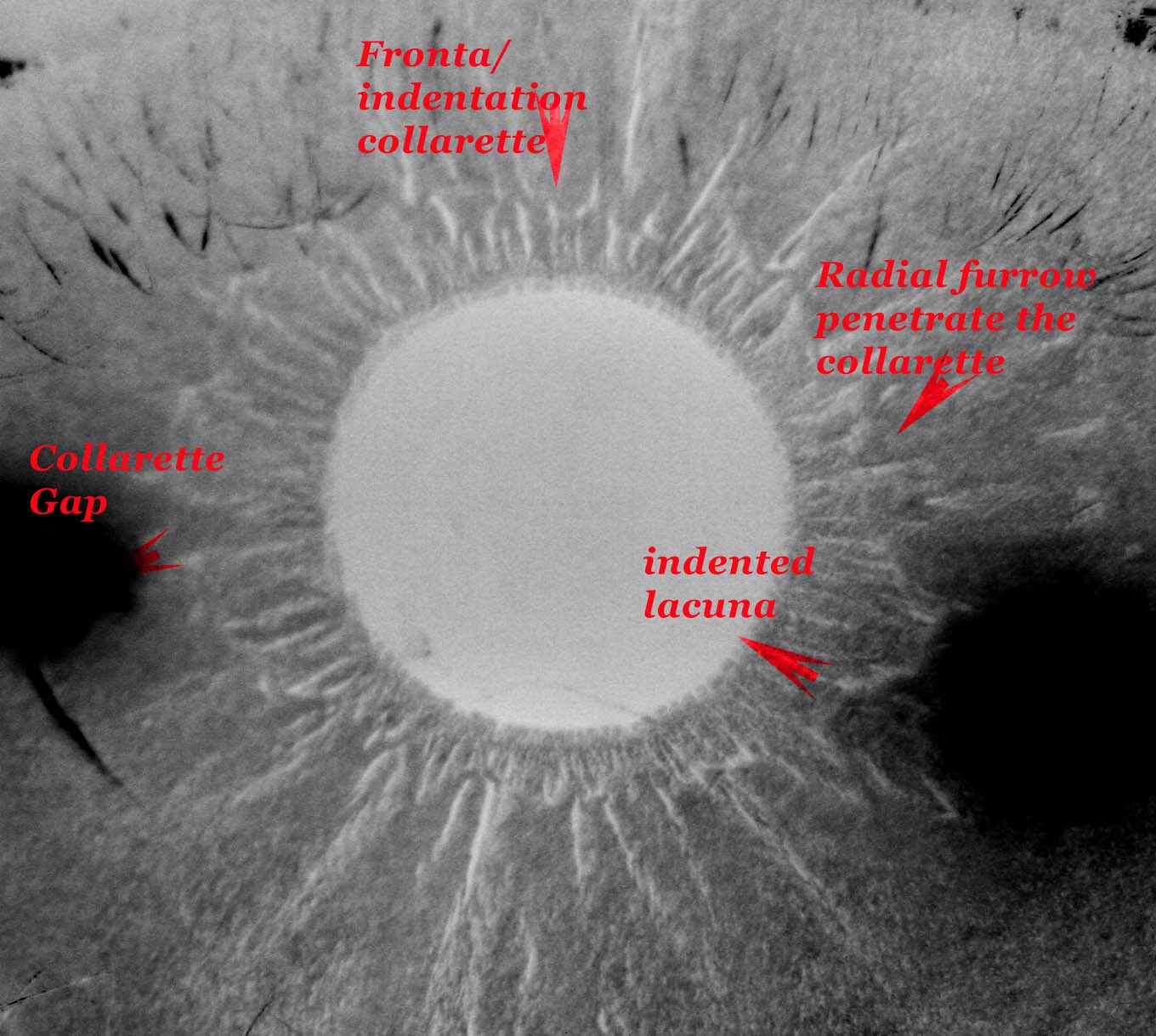 Modern & Multidimensional Iridology: The Integrity of the Collarette ...