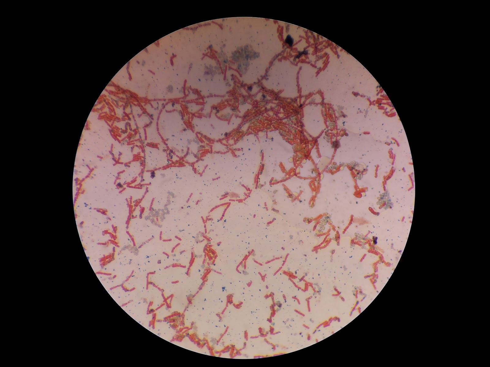 Wiasty Sukanty: Pewarnaan Spora