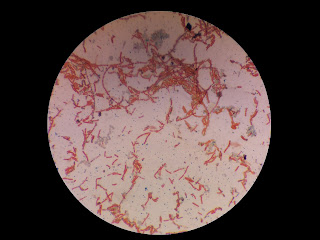 Wiasty Sukanty: Pewarnaan Spora