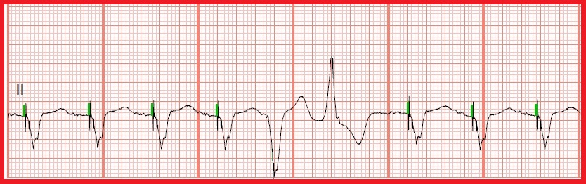 Practice EKG Rhythm Strips 199