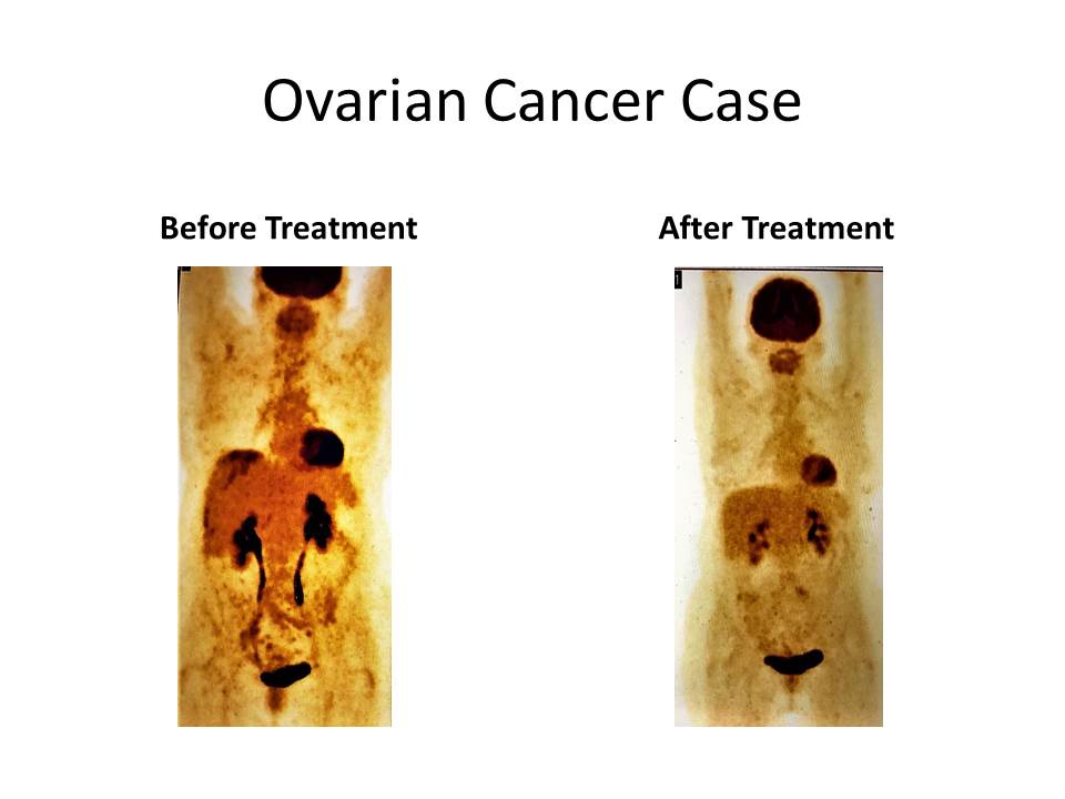 PROFESSOR SERGE JURASUNAS - NATUROPATHIC ONCOLOGY