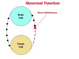 Chiropractic Perspective: Safety Pin Cycle