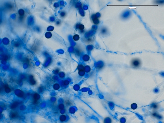 Fun With Microbiology (What's Buggin' You?): Sepedonium species