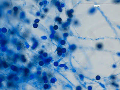 Fun With Microbiology (What's Buggin' You?): Sepedonium species