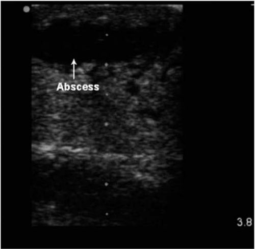 Imaging in Critical Care Case File