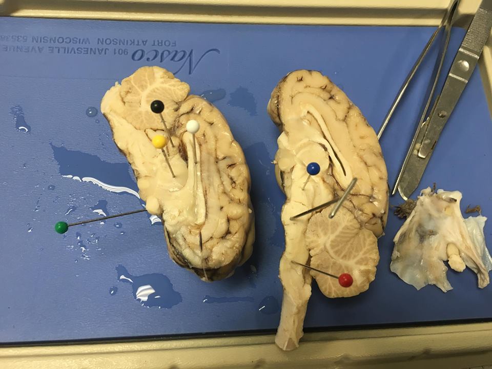 Nicole's Anatomy & Physio Blog: Sheep Brain Dissection