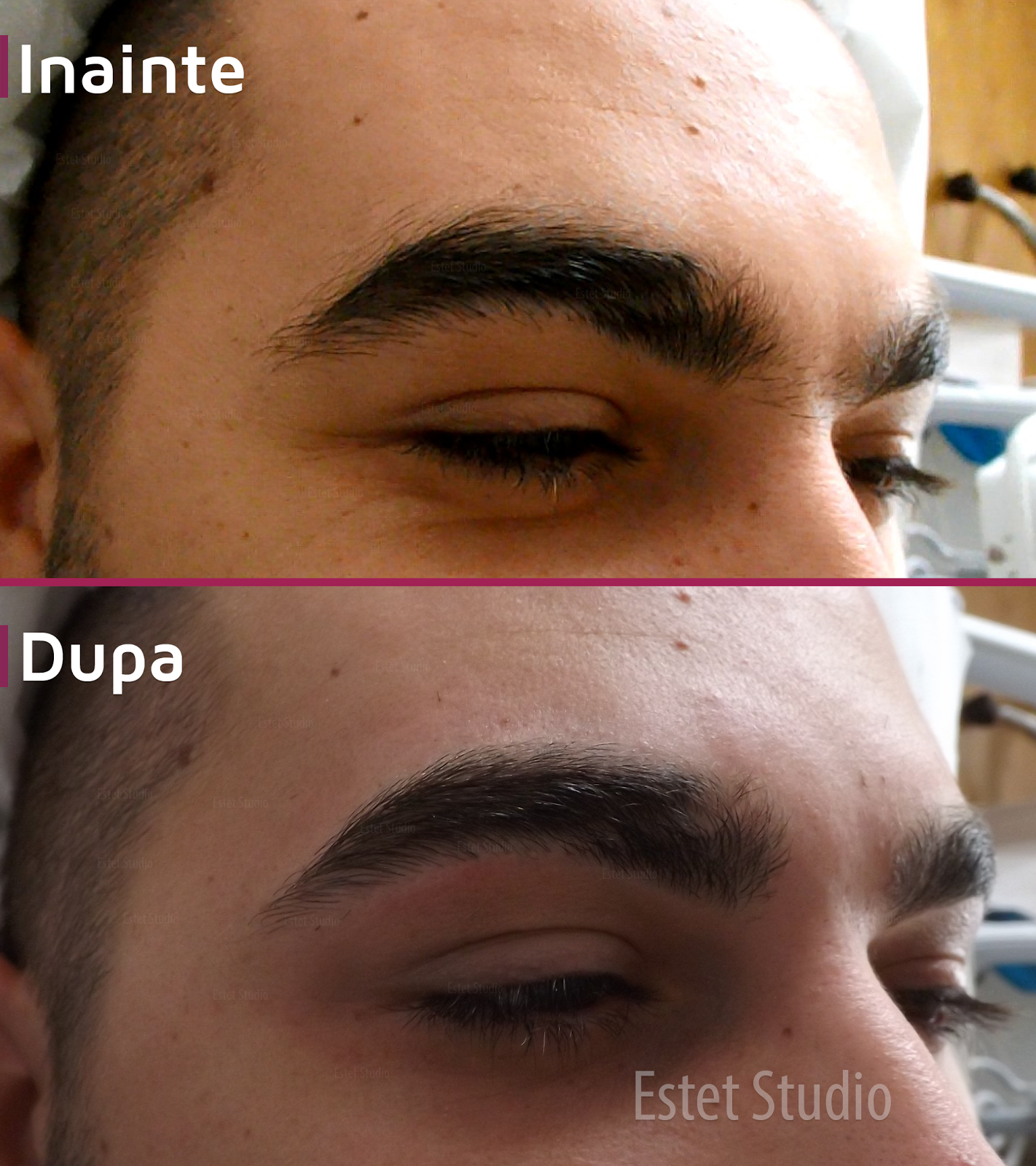 Elena Miron: Ingrijire Sprancene Barbati