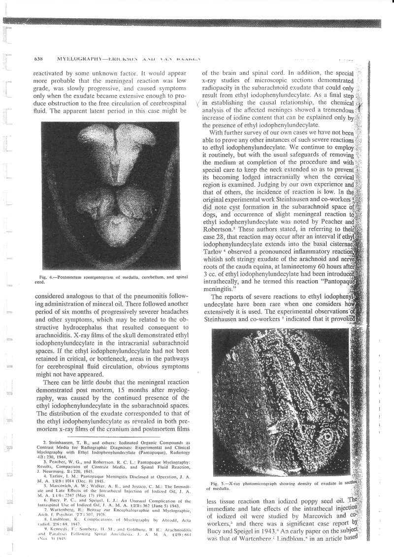 Myodil Murder's: 6. 3-Pantopaque, 1-Myodil, Medical Murder Cases
