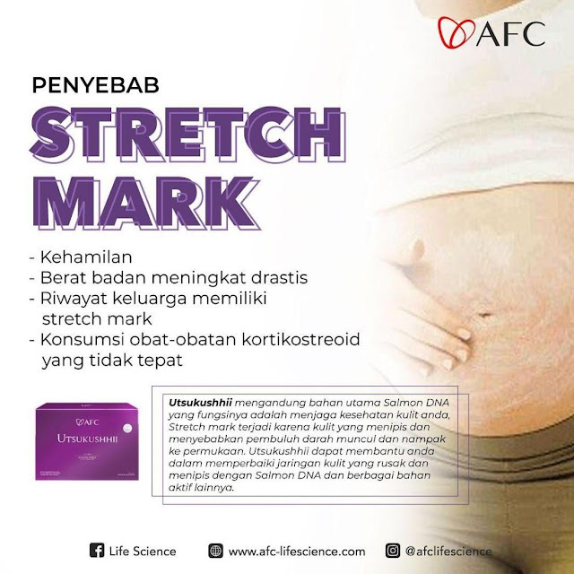 APA PATENT DAN FUNGSI SOP SUBARASHI - BISNIS AFC RAMSINA - Perusahan ...