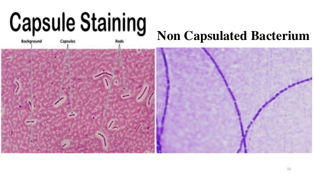 Kapsül Boyama - Microbiology Laboratory Turkey