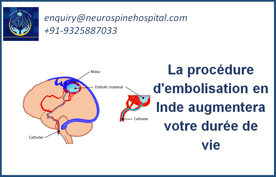 French to India Medical Travel: La procédure d'embolisation en Inde ...