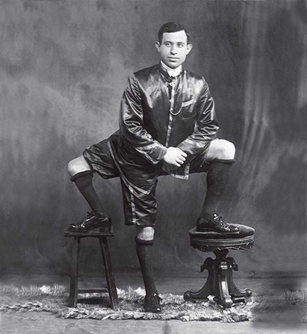 Francesco Lentini Pemain Sirkus Yang Memiliki 3 Kaki | Serem Banget