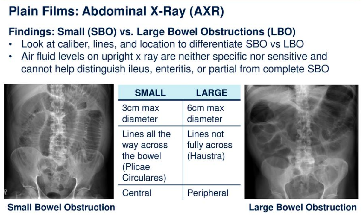 Small Bowel Obstruction Vs Large Bowel Obstruction