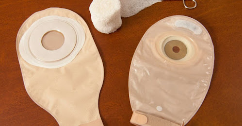 Ostomate's Corner: Tips To Use An Ostomy Bag And Pouching System