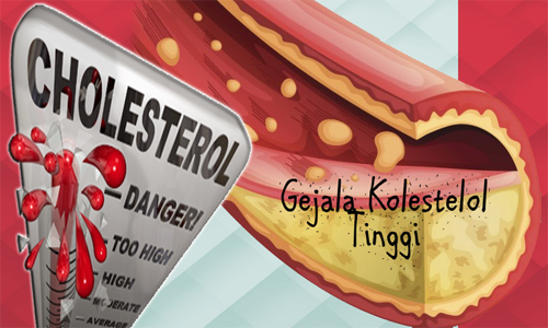 Ciri -ciri dan Tanda Kolestrol Tinggi Ciri -ciri dan Tanda Kolestrol Tinggi