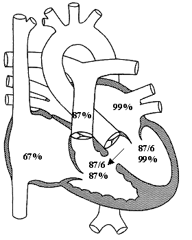 Medical Lecture Notes Online: Congenital Heart Disease (CHD)