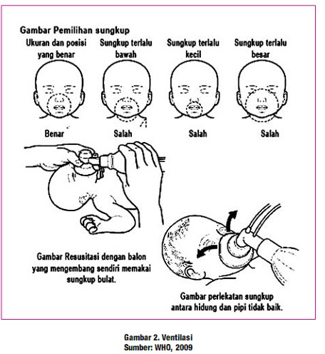 PERAWATAN NEONATAL ESENSIAL PADA SAAT LAHIR