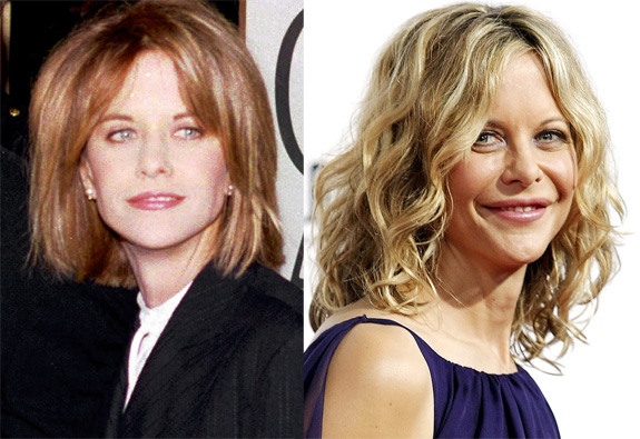 Meg Ryan Plastic Surgery